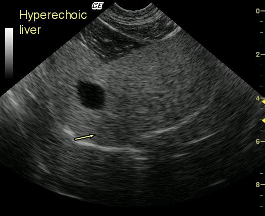 Hepatic vacuolar changes, lipidosis, and cell necrosis in a 10 year old ...