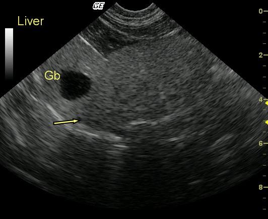 Hepatic vacuolar changes, lipidosis, and cell necrosis in a 10 year old ...