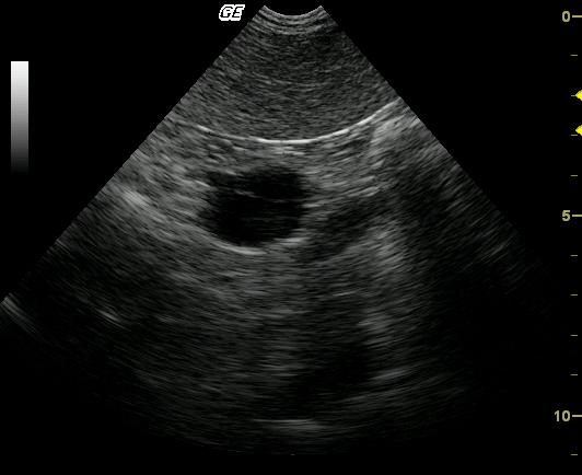 Histiocytic Sarcoma of the Colon in an 11 year old MN Boxer dog - Members