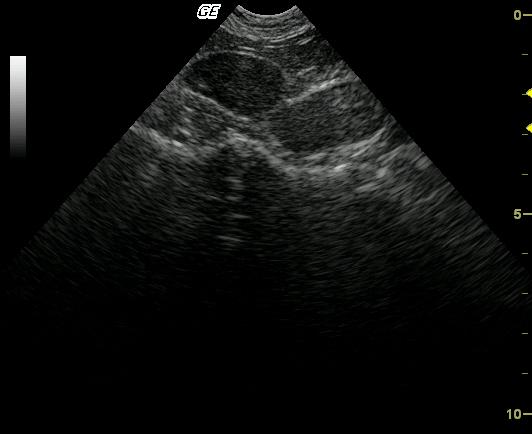 Histiocytic Sarcoma of the Colon in an 11 year old MN Boxer dog - Members