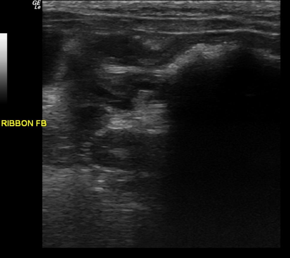 Linear Foreign body in a 5 month old MN cat - Members
