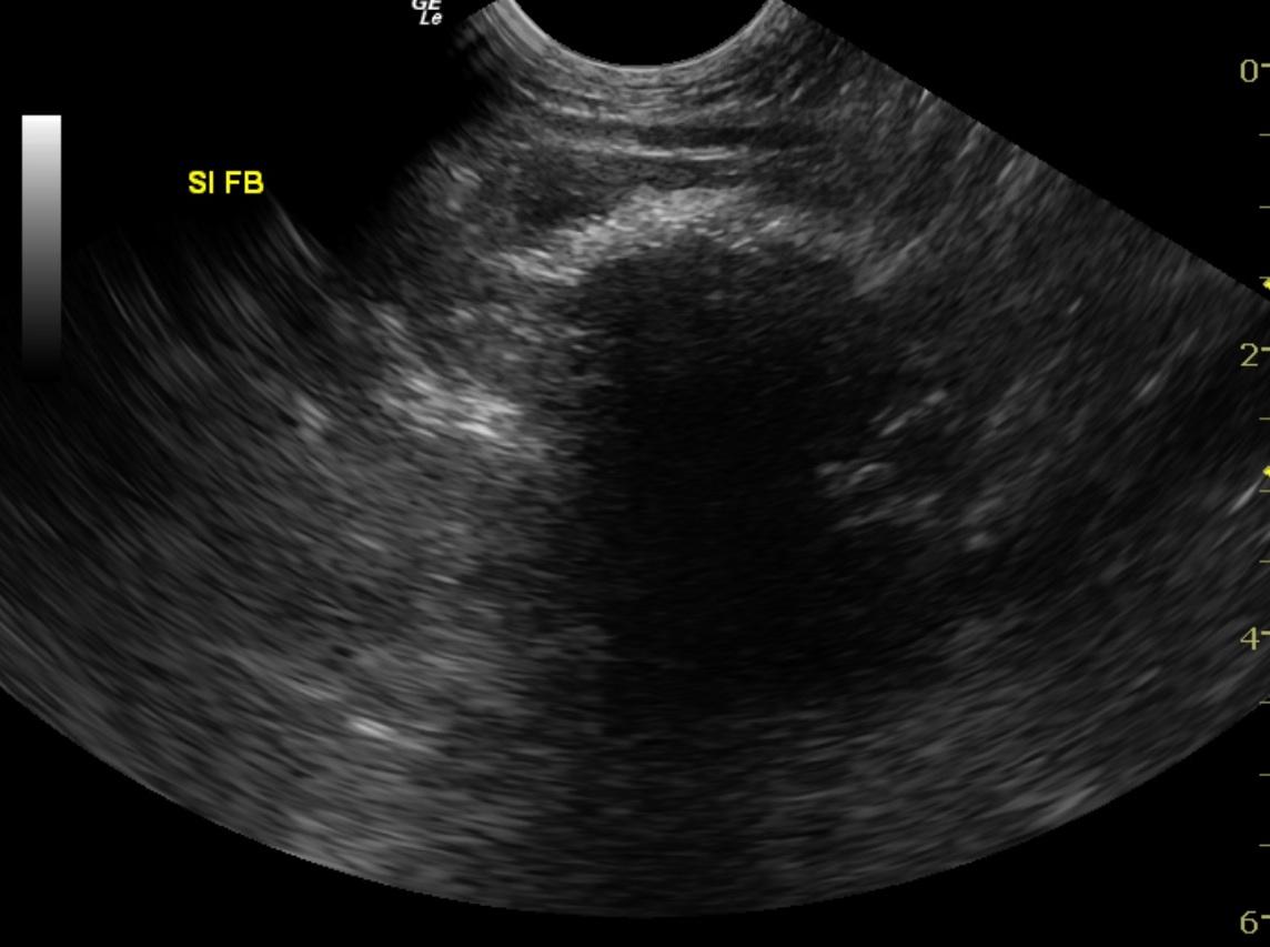 Linear Foreign body in a 5 month old MN cat - Members