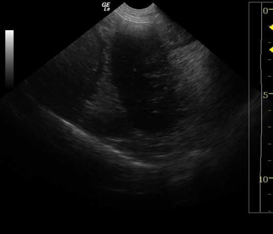 Corn cob intestinal foreign body in a 5 year old FS Labrador Retriever ...