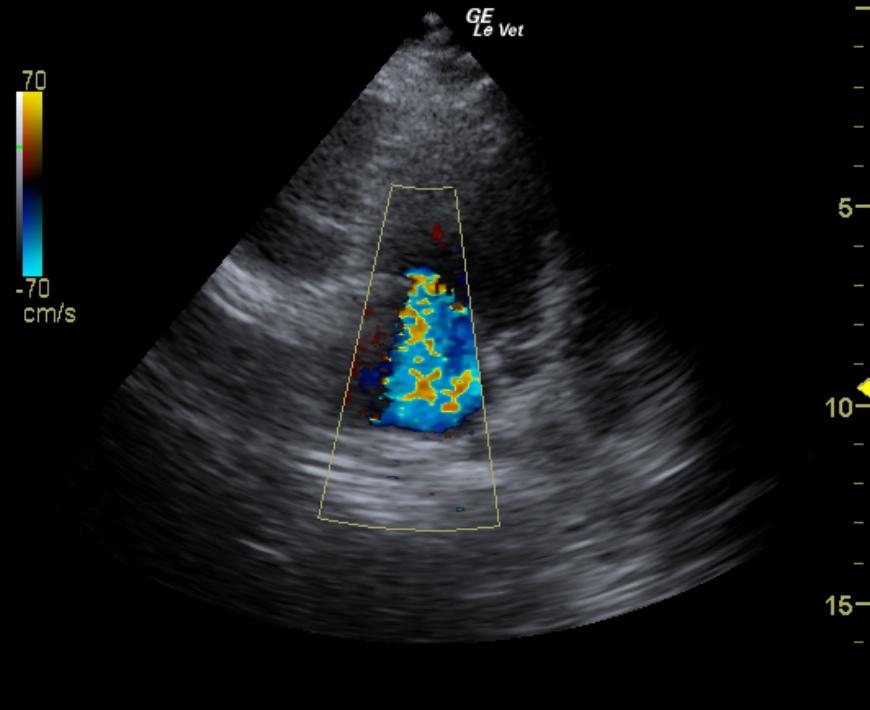 Congestive heart failure, valvular disease, myocardial insufficiency ...