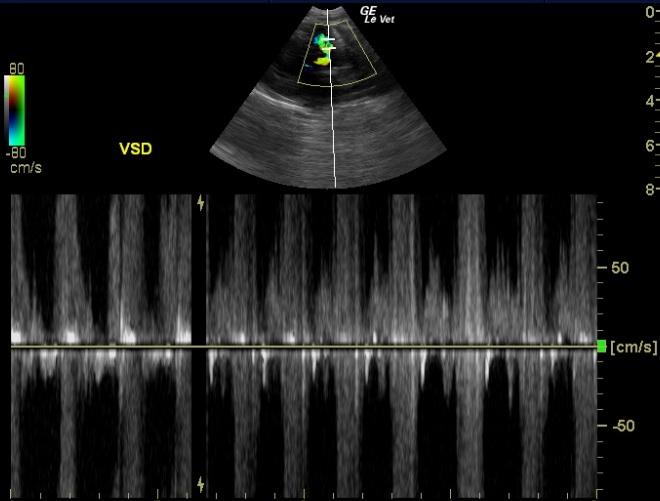 Membranous ventricular septal defect (VSD) in a 2 month old FI French ...