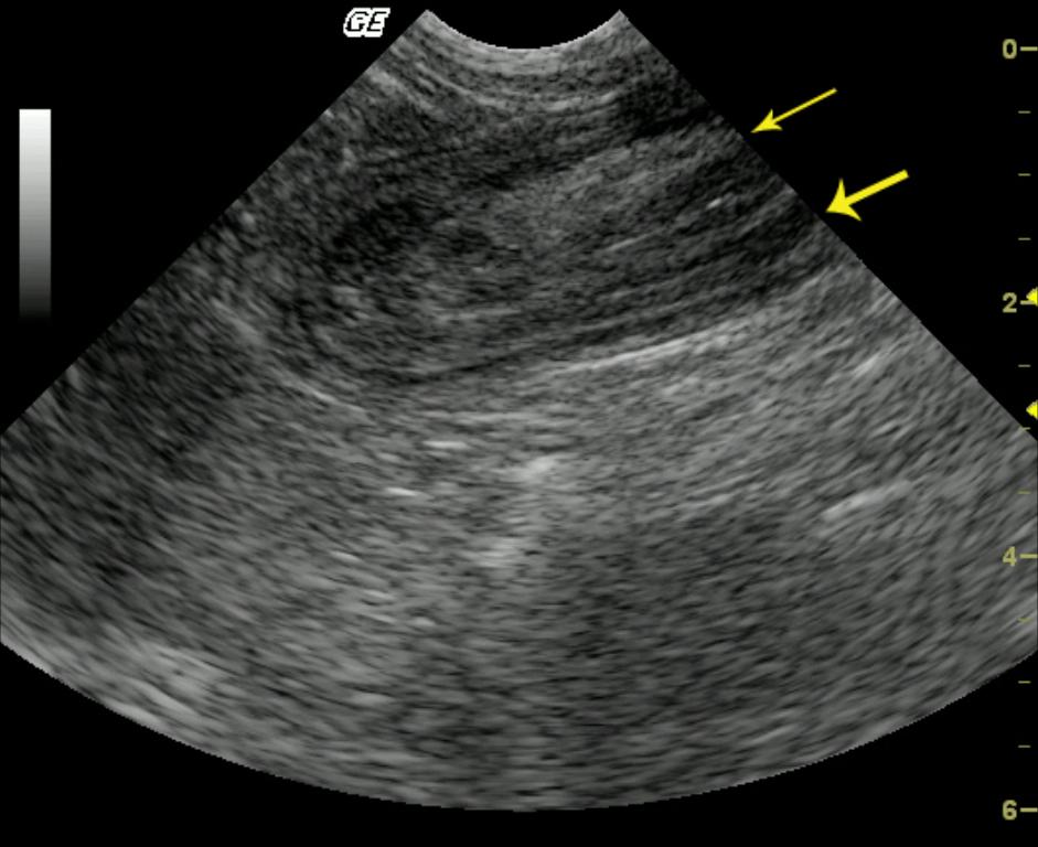 Jejunal intussusception in a 2 year old FS DSH cat - Members