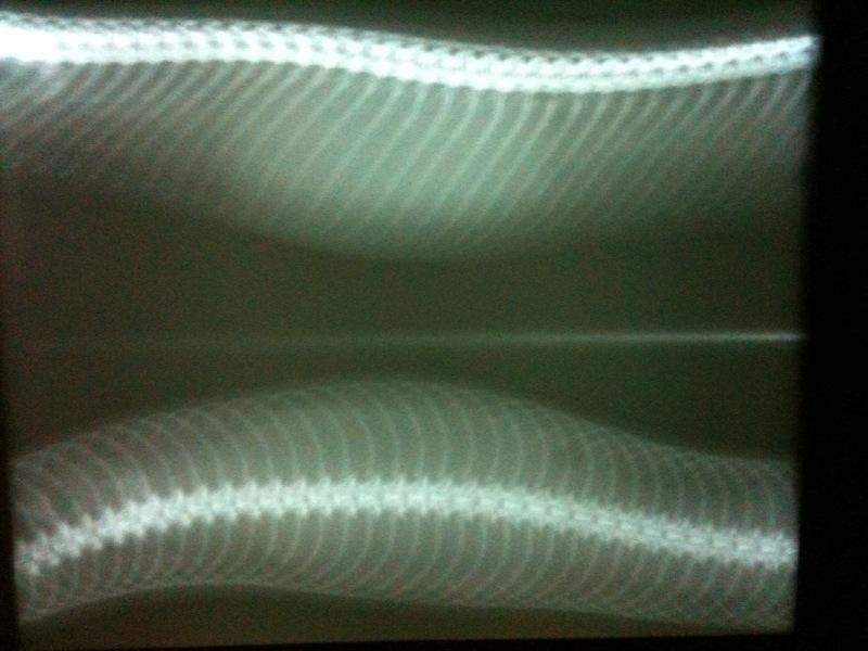 Seminoma in a 26 year old MI Boa Constrictor snake. - Members