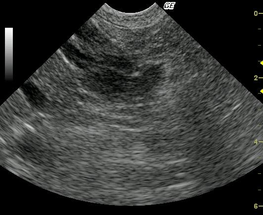 Gastric epithelial tumor and pancreatic cyst in a 10 year old MN Beagle ...