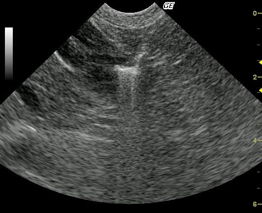 Gastric epithelial tumor and pancreatic cyst in a 10 year old MN Beagle ...