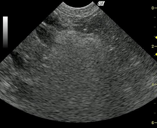 Gastric epithelial tumor and pancreatic cyst in a 10 year old MN Beagle ...