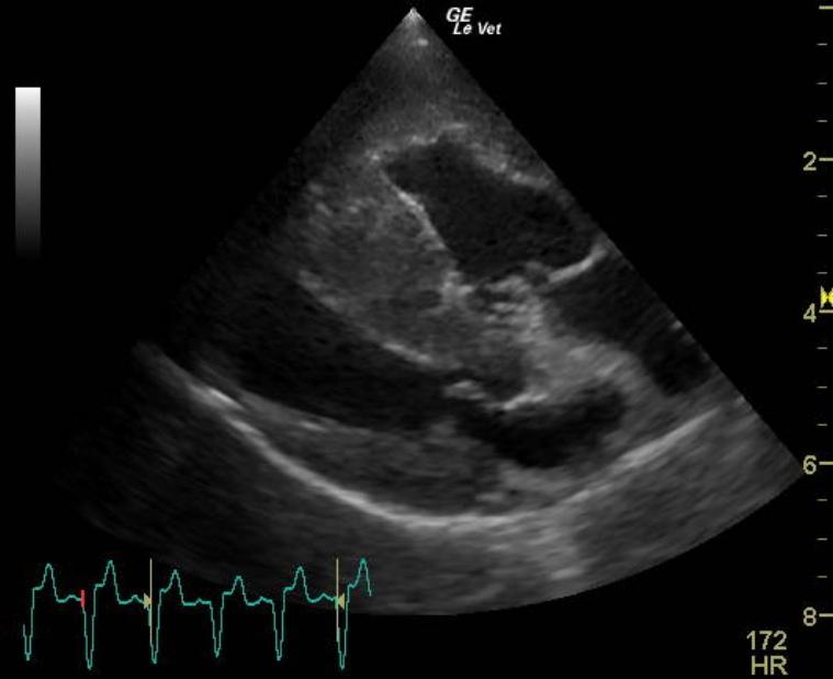 Right ventricular hypertrophy and pulmonary hypertension due to ...