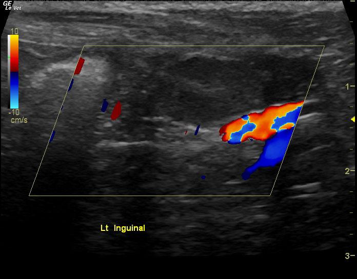 Benign prostatic hyperplasia and an inguinal testis (unilateral ...
