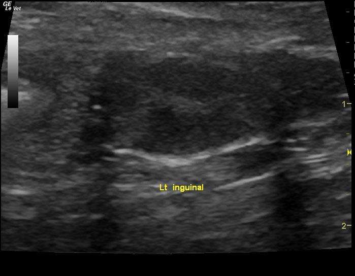 Benign prostatic hyperplasia and an inguinal testis (unilateral ...