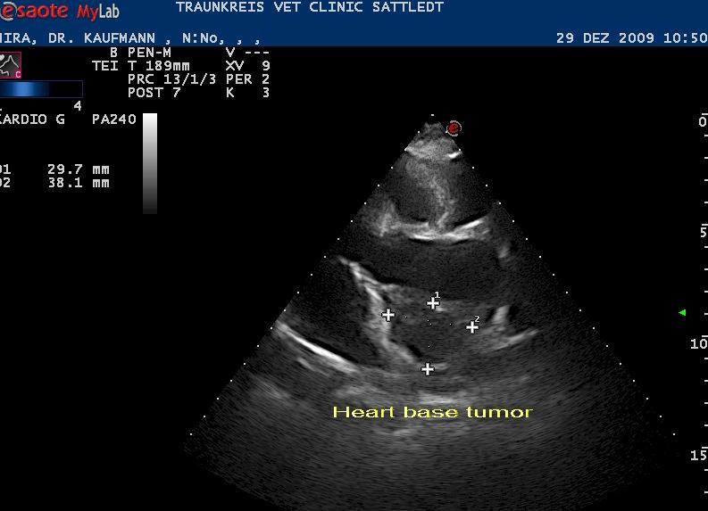 Heart Based Tumor - Members
