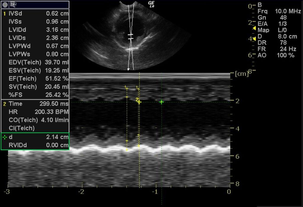 Dilated Cardiomyopathy (DCM)-like Syndrome Secondary to Parvoviral ...