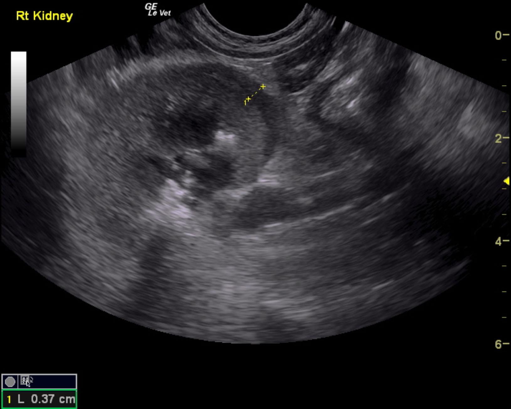 Obstructive urolithiasis, pyelonephritis, nephritis, and bladder stones ...