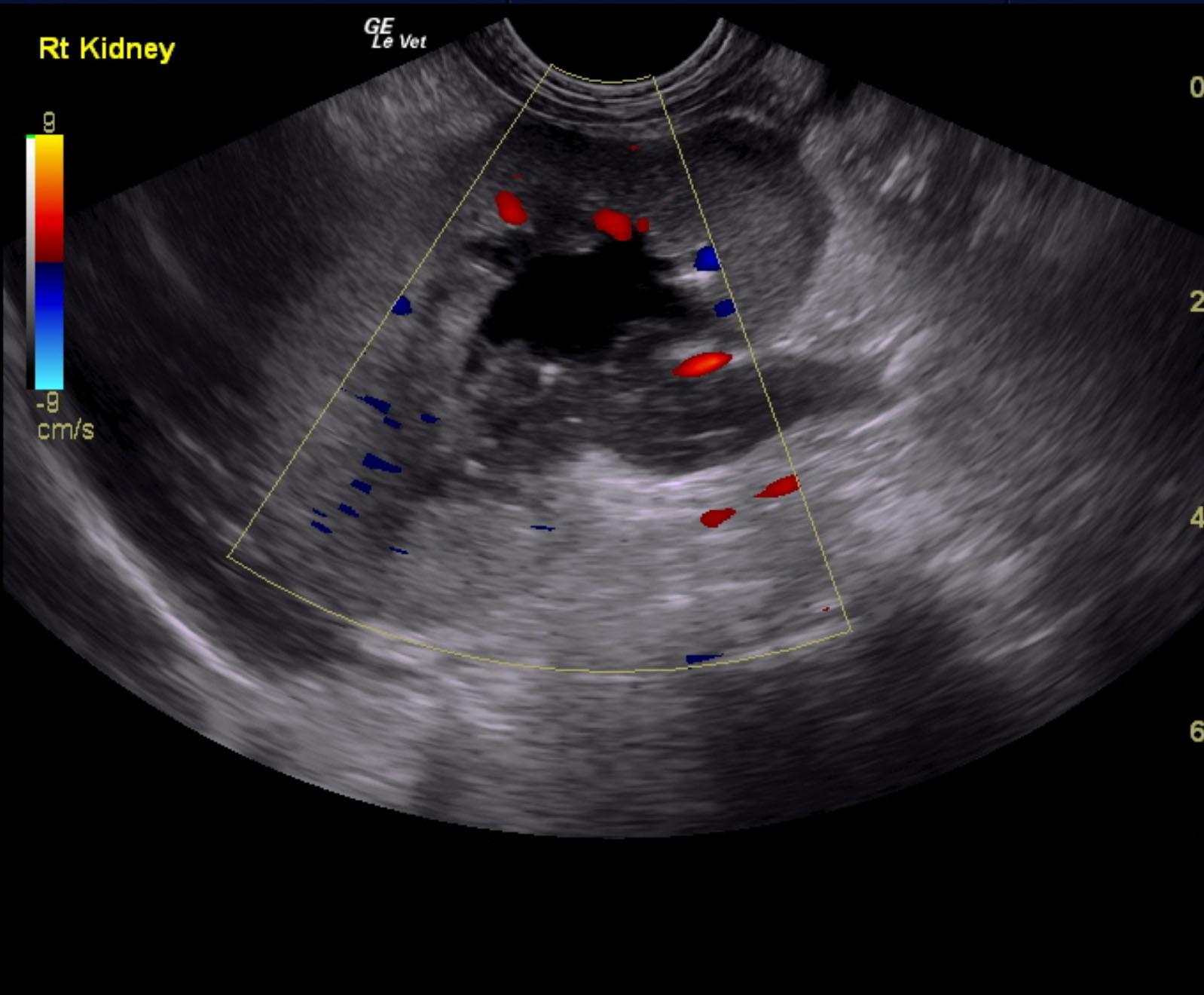 Obstructive urolithiasis, pyelonephritis, nephritis, and bladder stones ...