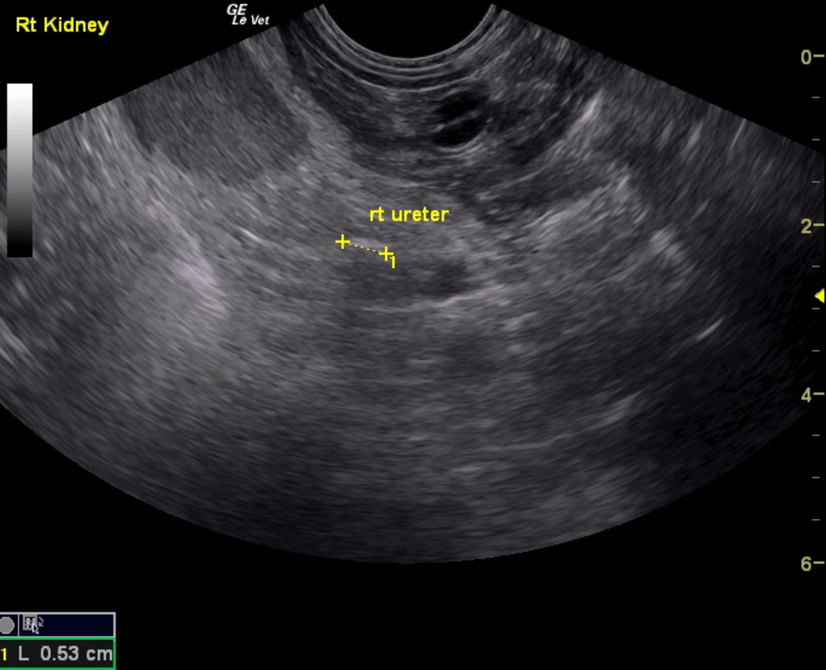 Obstructive urolithiasis, pyelonephritis, nephritis, and bladder stones ...