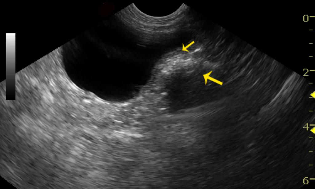 A normal abdominal ultrasound of a canine - Members