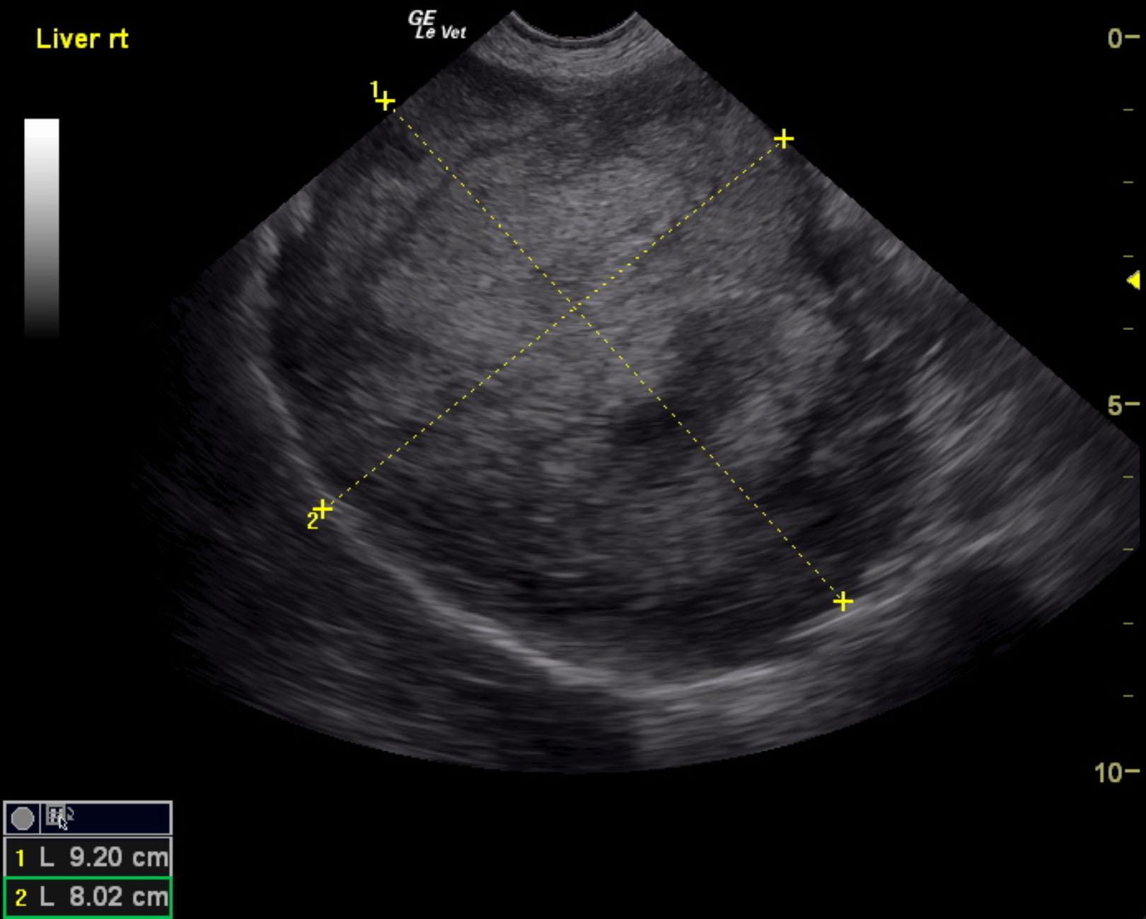 03_00433 Liberty C Mixed echoic liver masses - Members