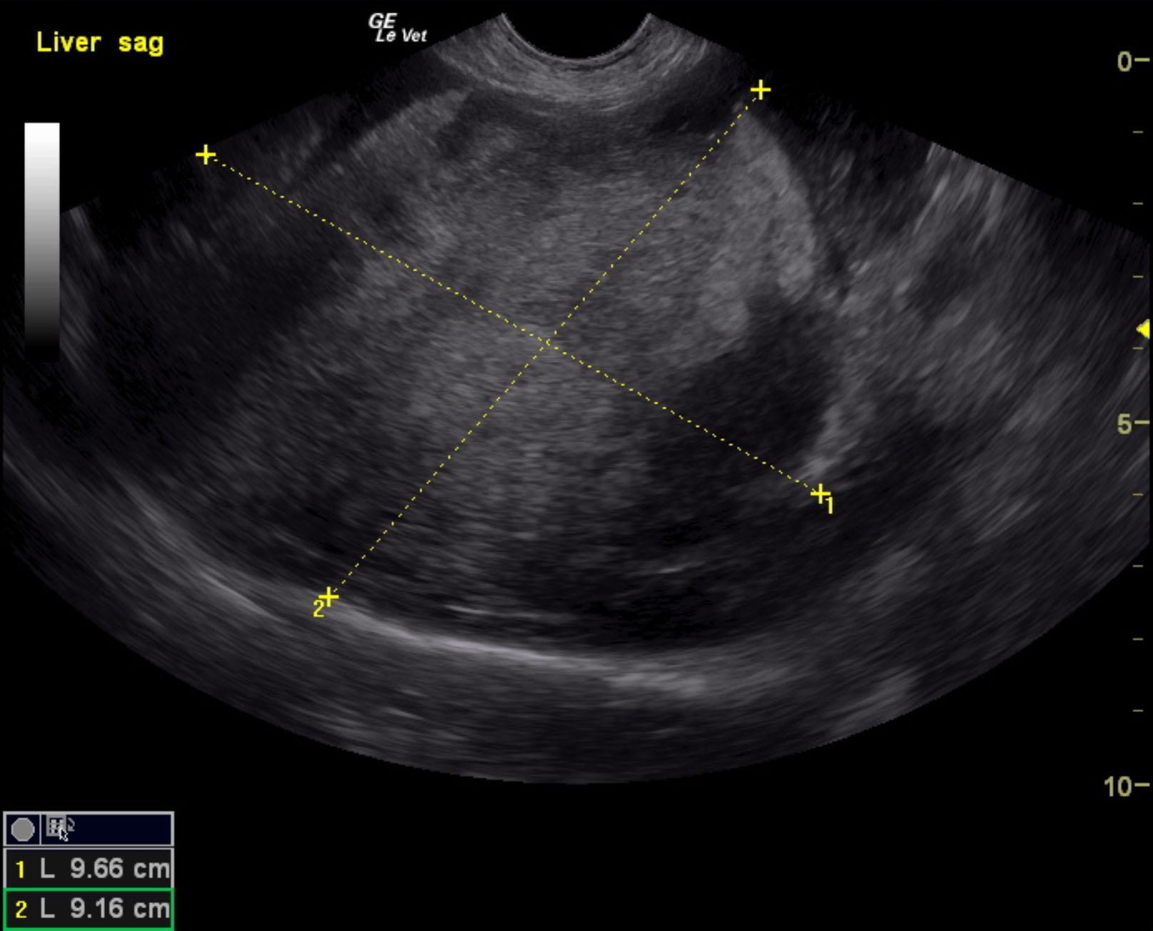 03_00433 Liberty C Mixed echoic liver masses - Members