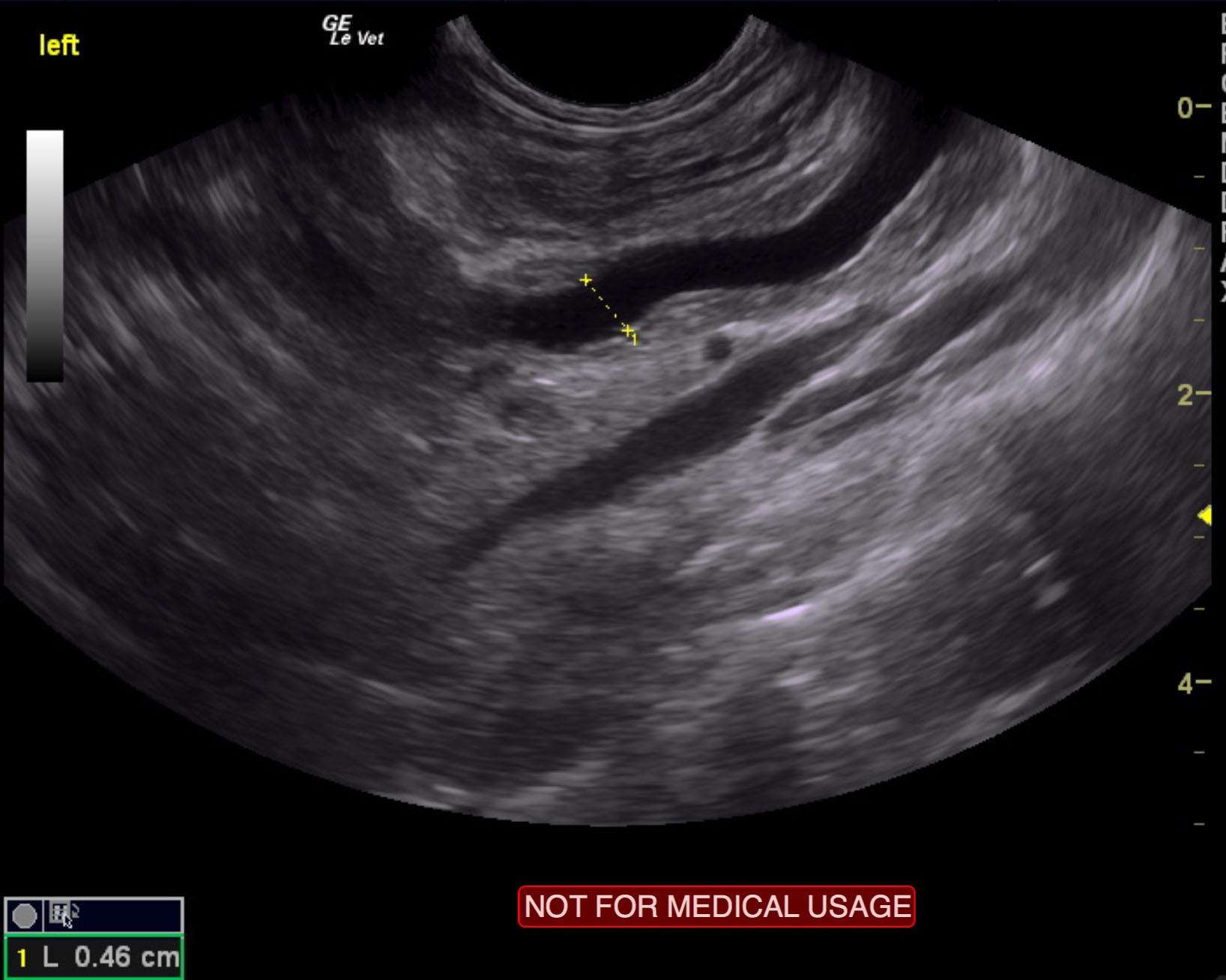 Multfocal biliary mineralization in a 16 year old MN DLH cat - Members
