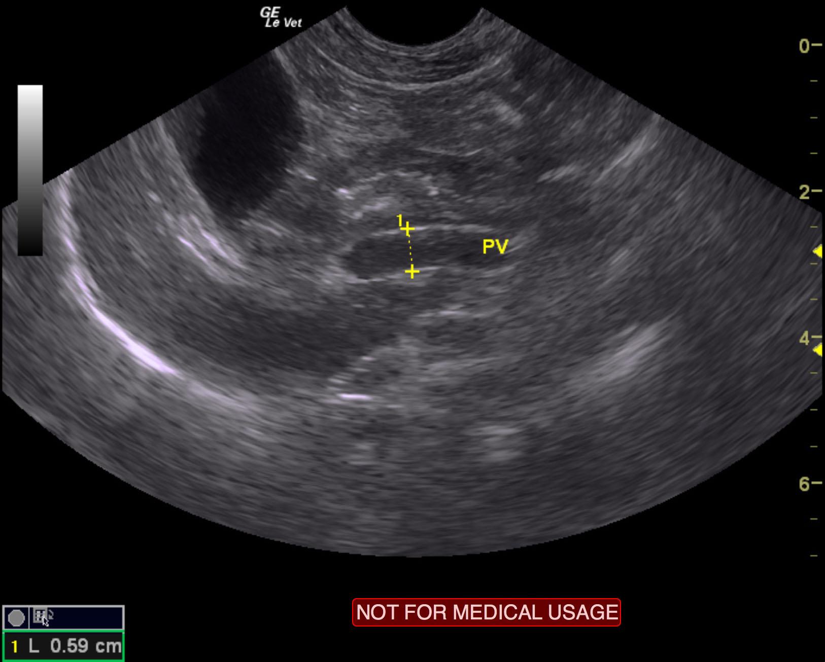 Follow up Ultrasound Post Surgical Repair Of Portosystemic Shunt In A