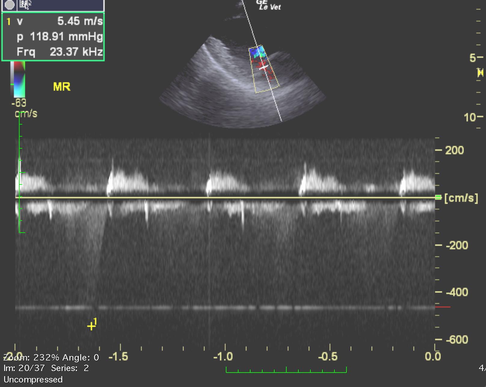 15-00212 Joshua H PDA, LVE, Pneumonia - Members
