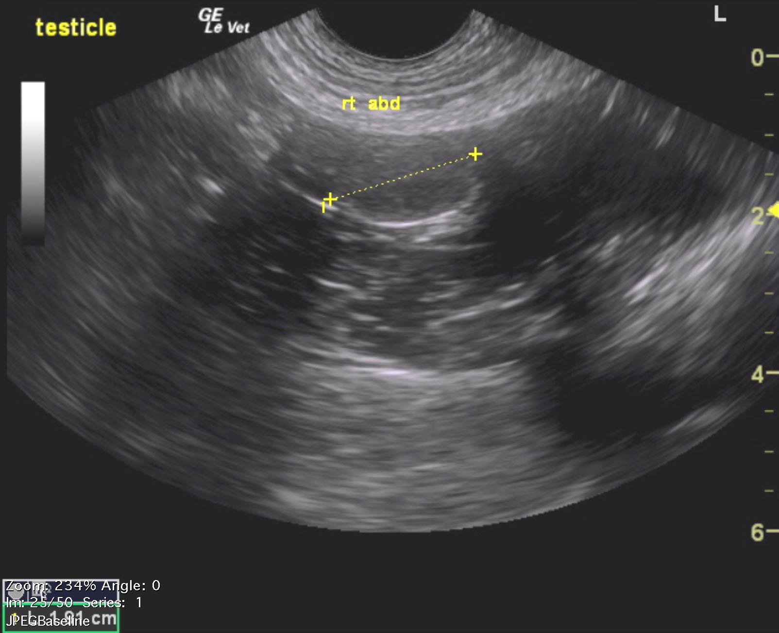 09_00103 Grady S Bilateral cryptorchid. Unilateral neoplastic testicle ...