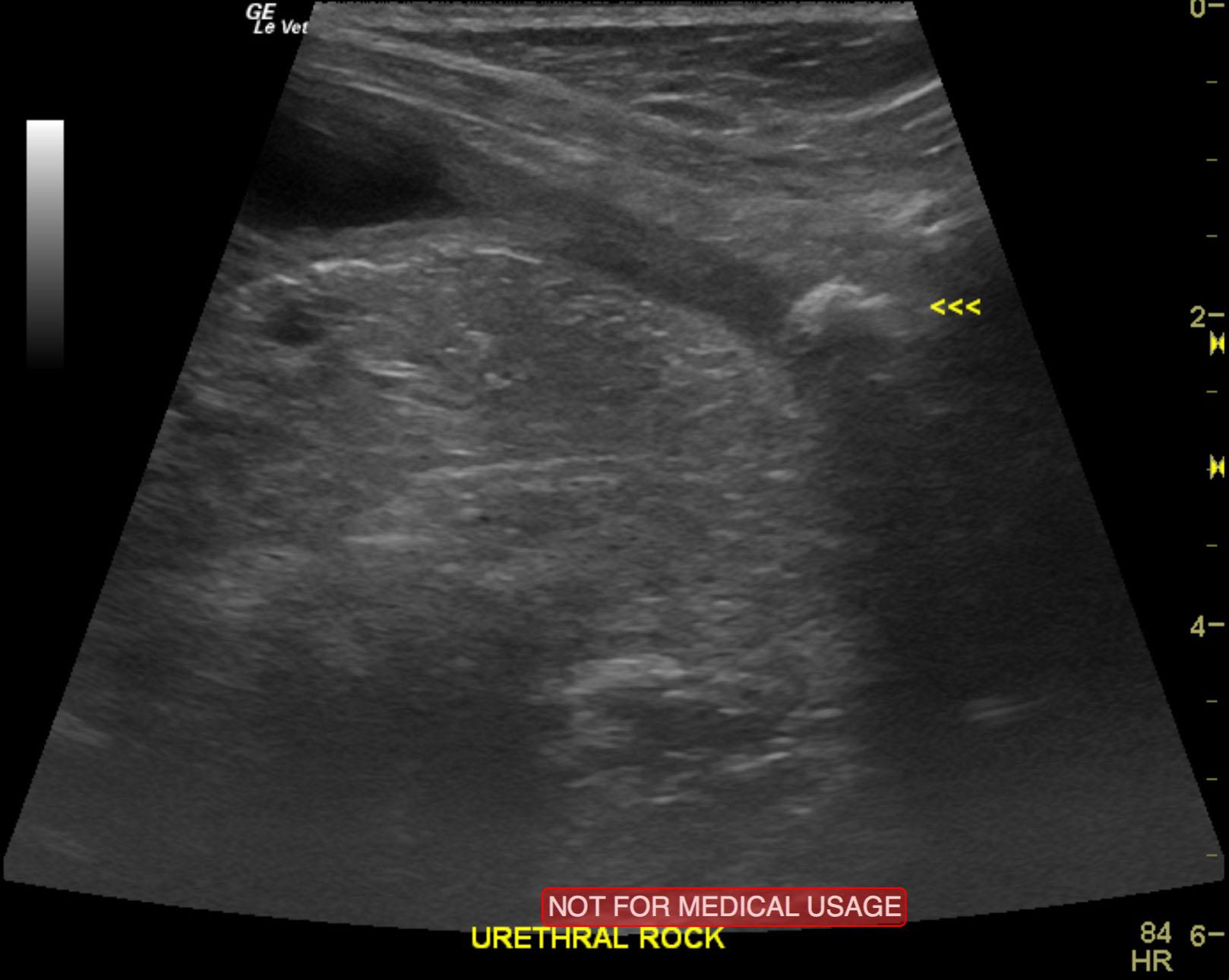 06_00263 Lexy L Urethral stone - Members