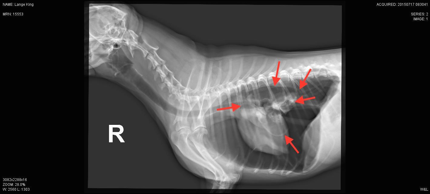 RADS - Bilateral Pneumothorax and Pulmonary Collapse in a 5 year old MN ...