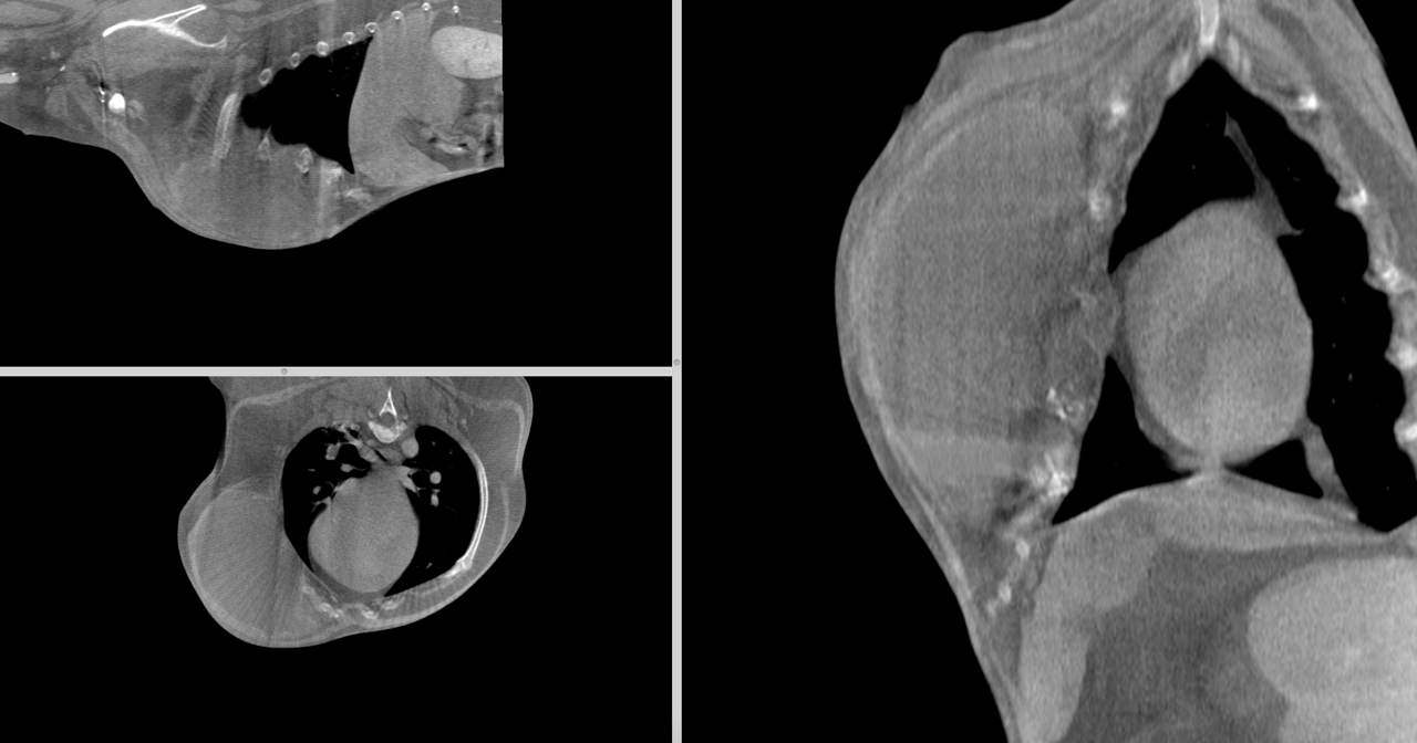 CT Mesenchymal Soft Tissue Neoplasia on Thoracic Wall, with Reactive ...