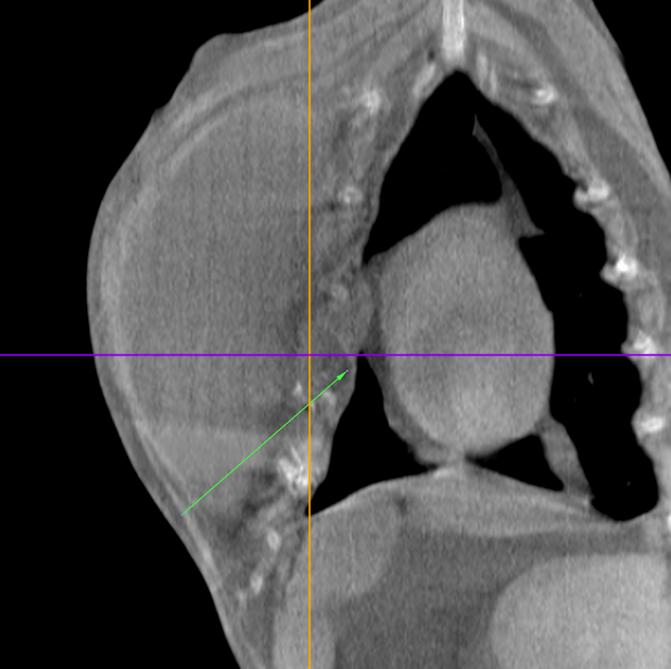 CT Mesenchymal Soft Tissue Neoplasia on Thoracic Wall, with Reactive ...