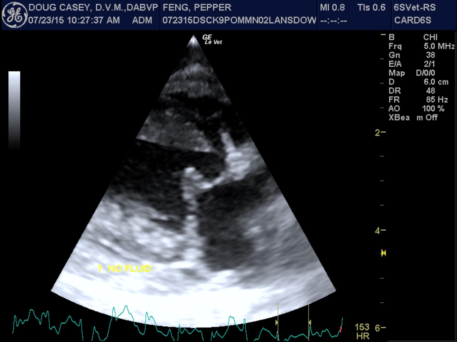 Degenerative Mitral Valve Disease, Pericardial Effusion and Left Atrial ...