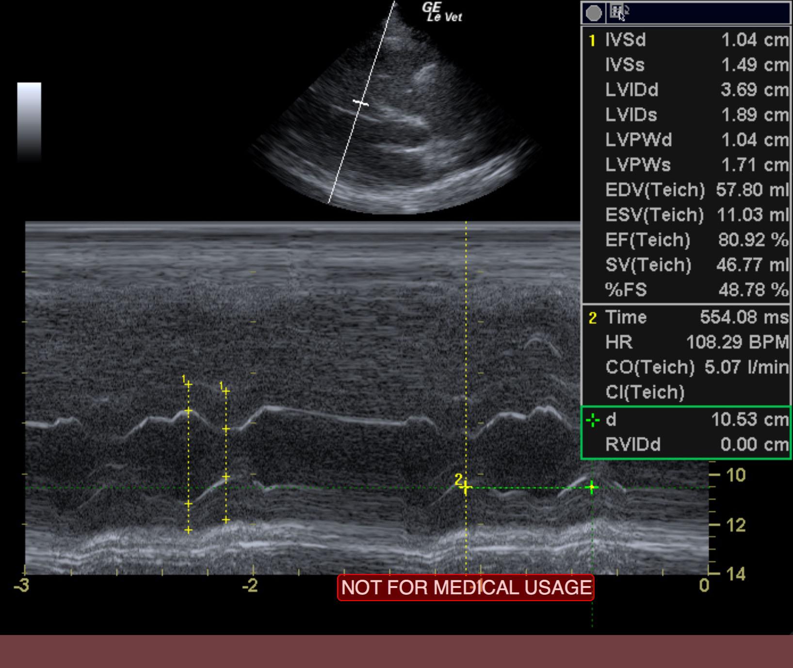 Primary Tricuspid Valve Dysplasia With Mild Pulmonary Hypertension In A 8 Year Old Fs Labrador