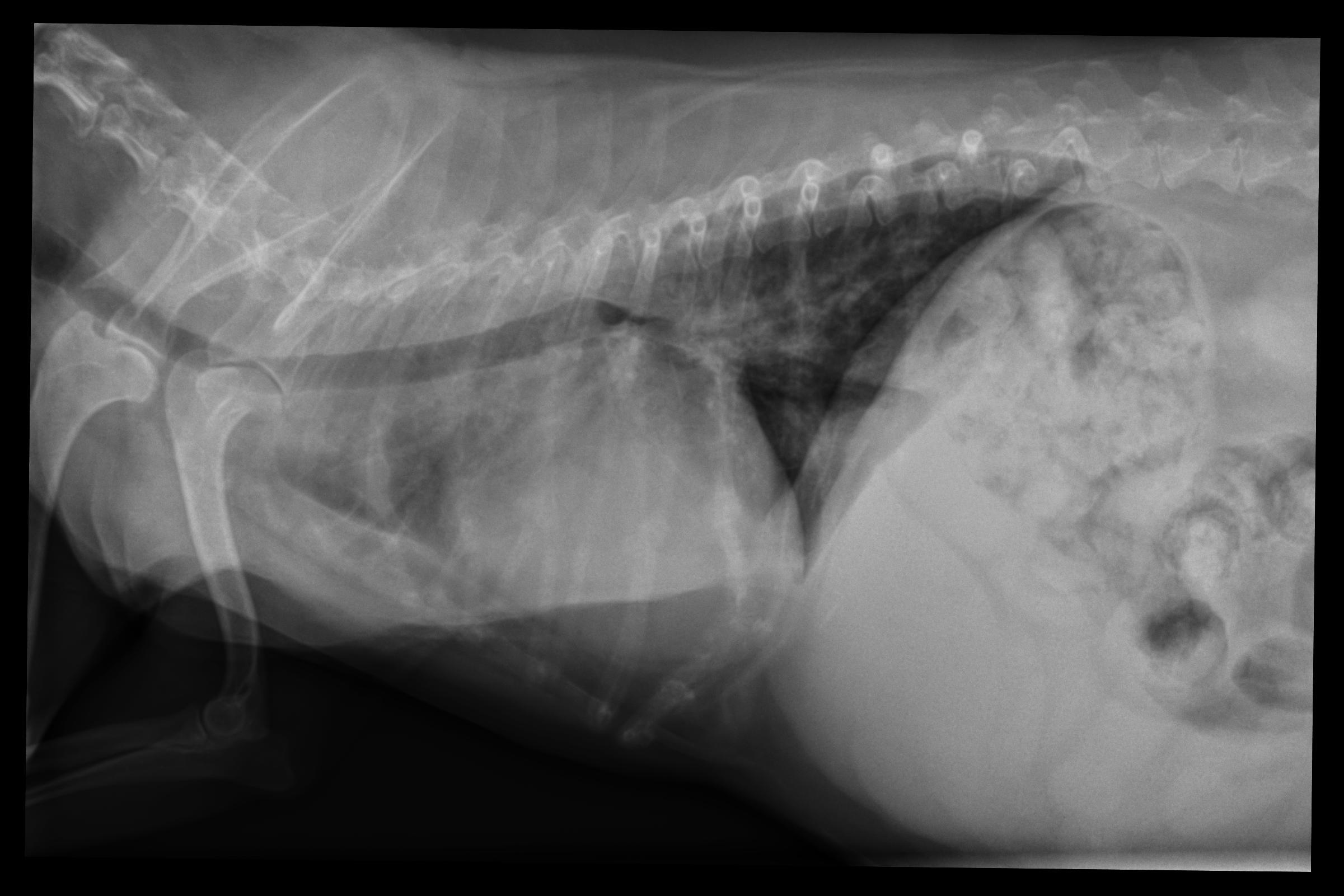 RADS - Congestive Heart Failure and Pulmonary Edema, possible Liver ...