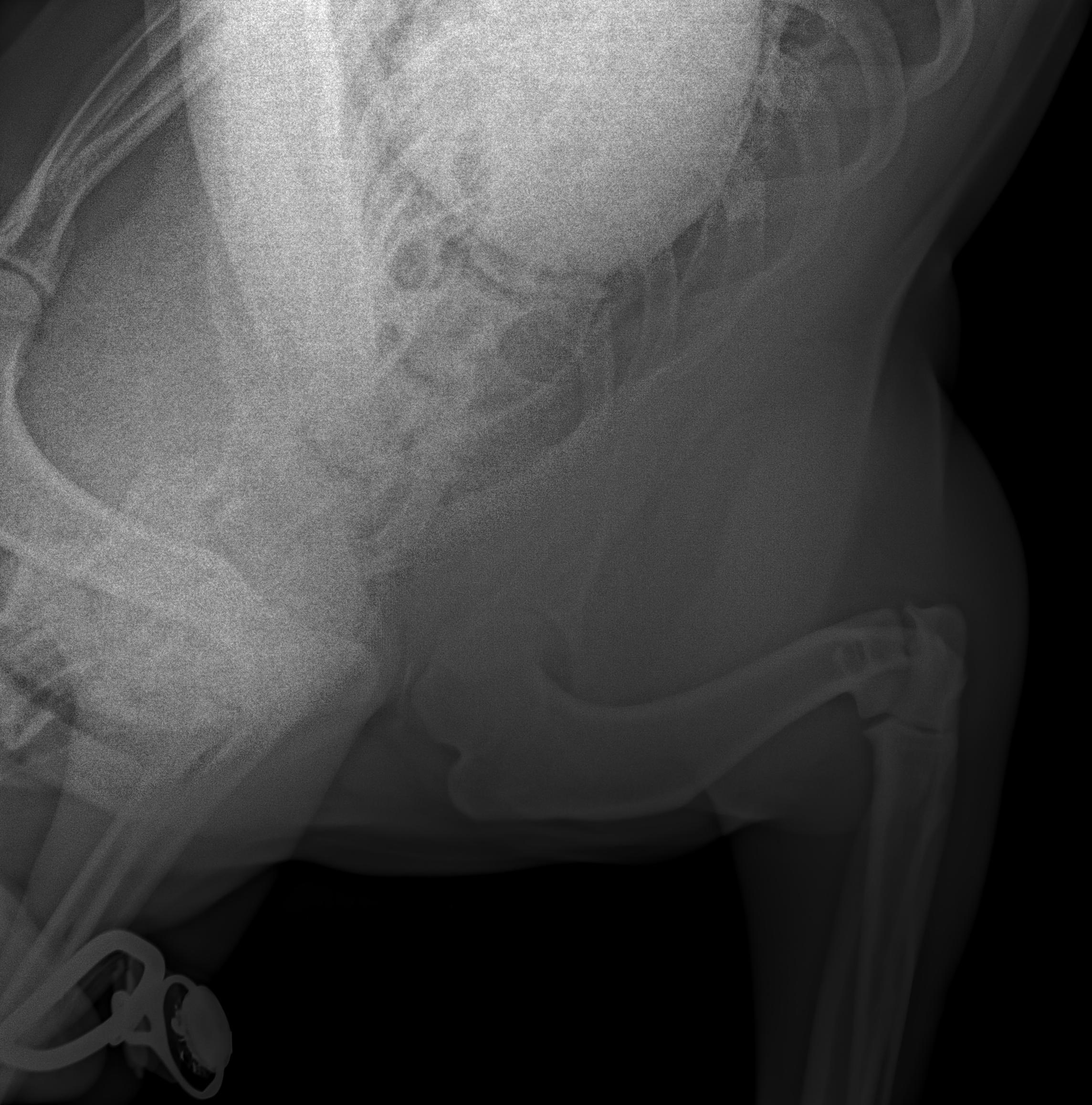 RADS - Elbow Soft Tissue Swelling with Likely Traumatic Cause in a 2 ...