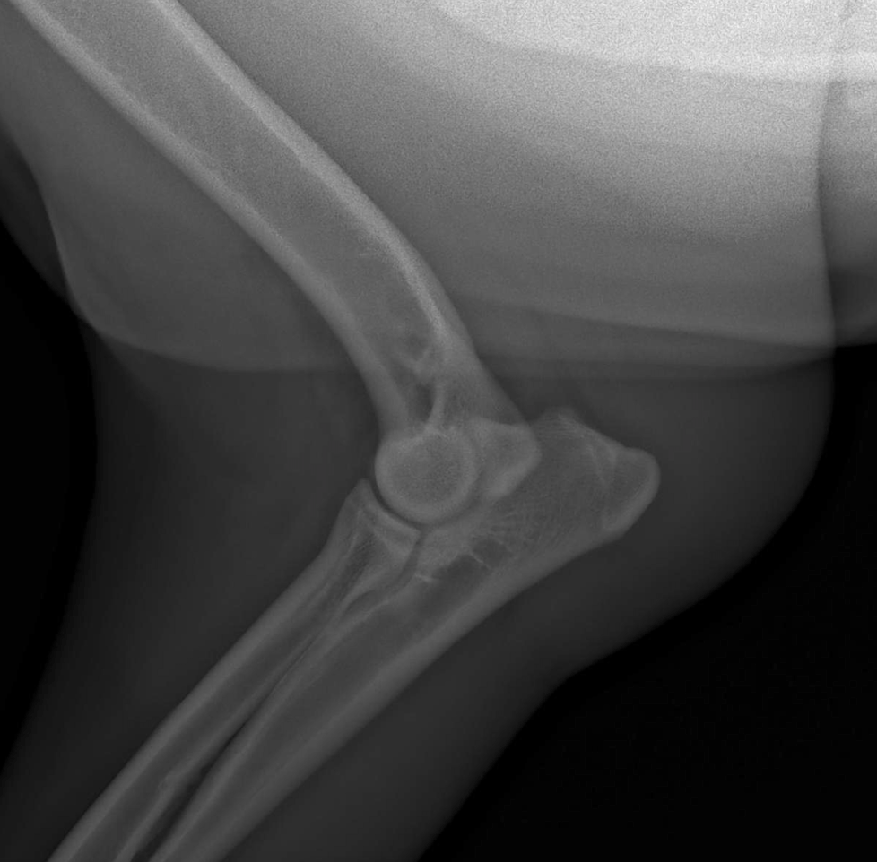 RADS - Elbow Soft Tissue Swelling with Likely Traumatic Cause in a 2 ...