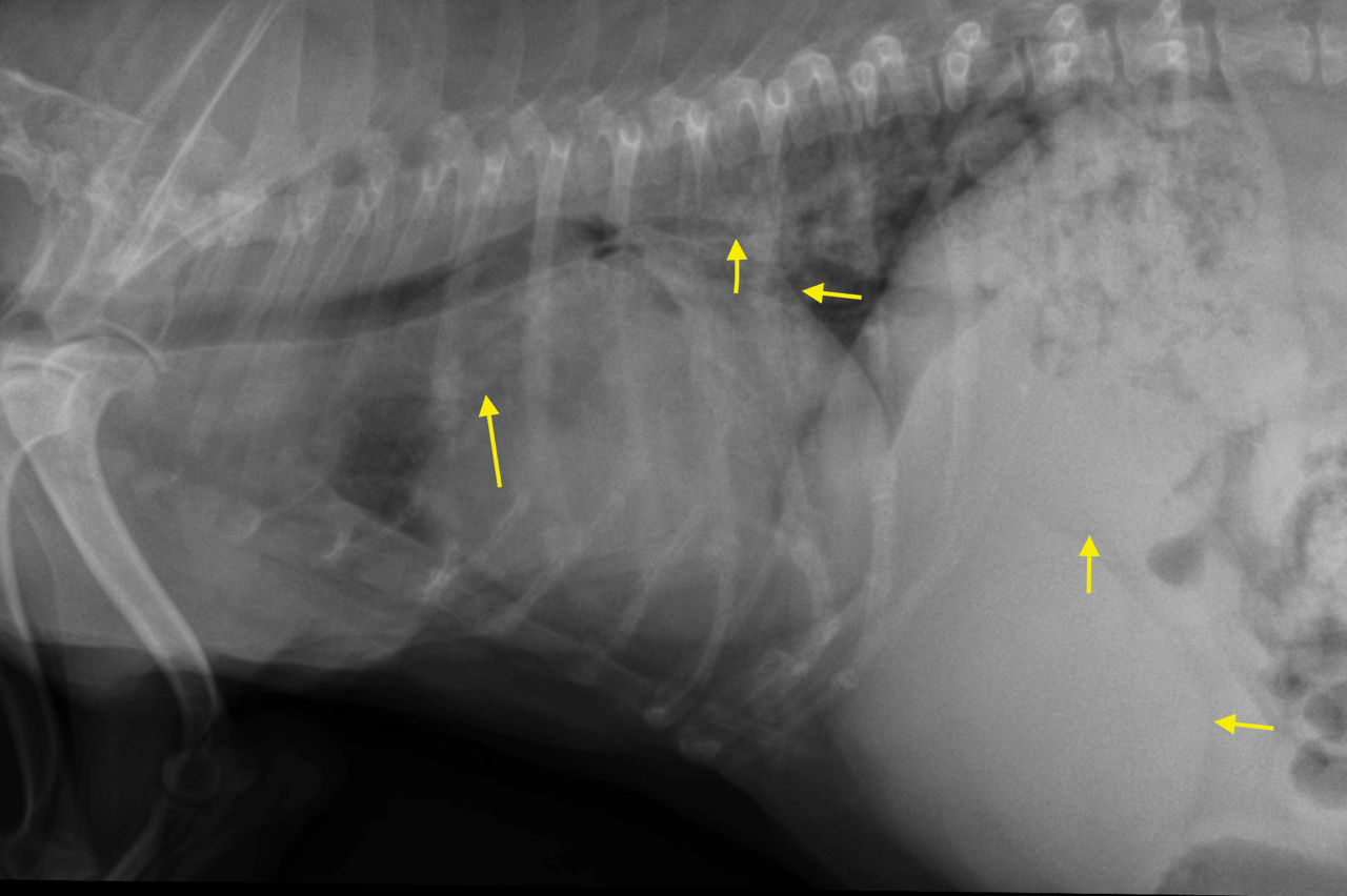 RADS - Congestive Heart Failure and Pulmonary Edema, possible Liver ...