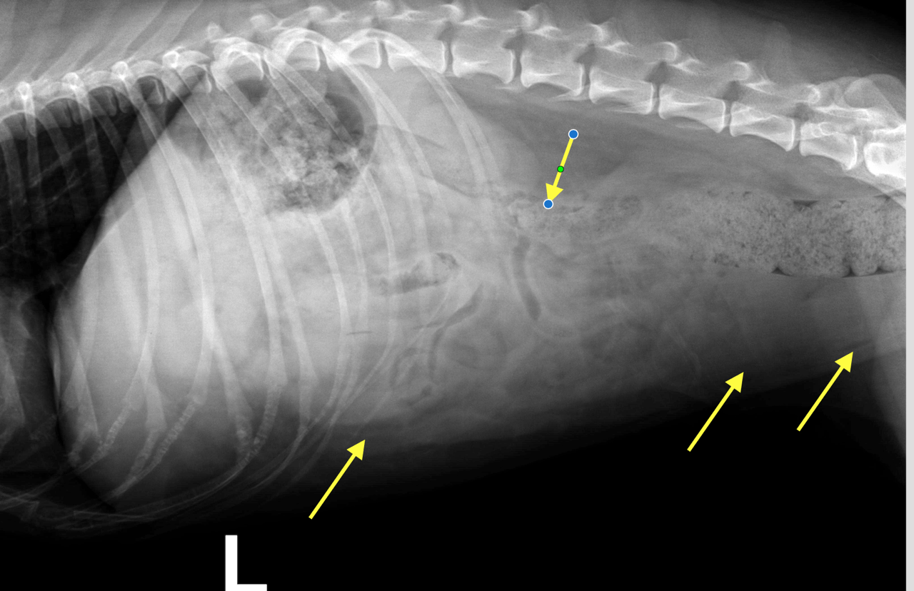 RADS - Mass Effect, Peritoneal Effusion or Peritonitis in a 11 year old ...