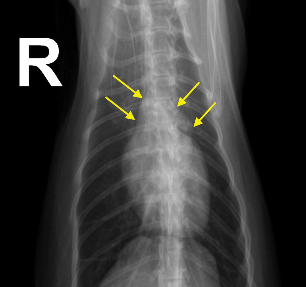 RADS - Normal Age-Related Cardiac and Axial Skeleton Changes with ...