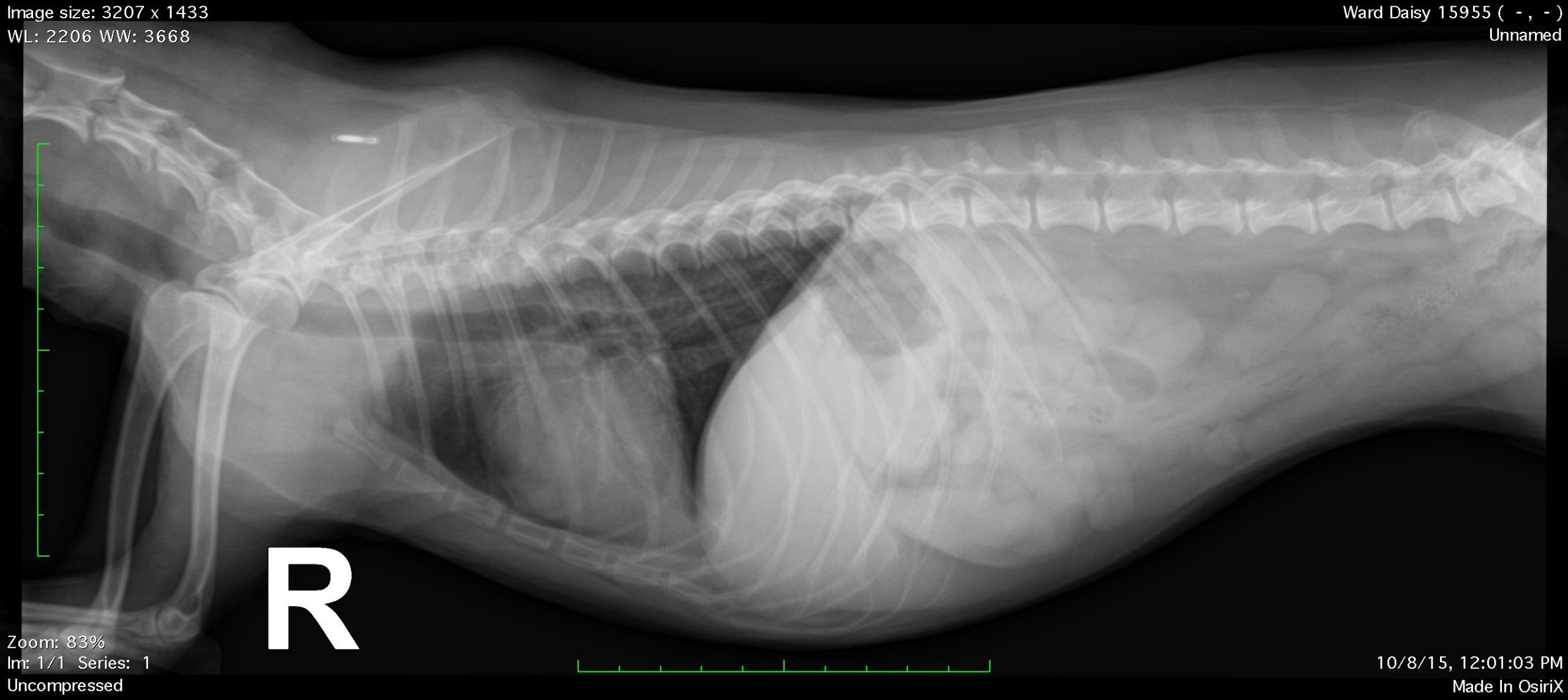 RADS -Hypovolemia, Underperfusion of the Lung, and Secondary Ileus in a ...