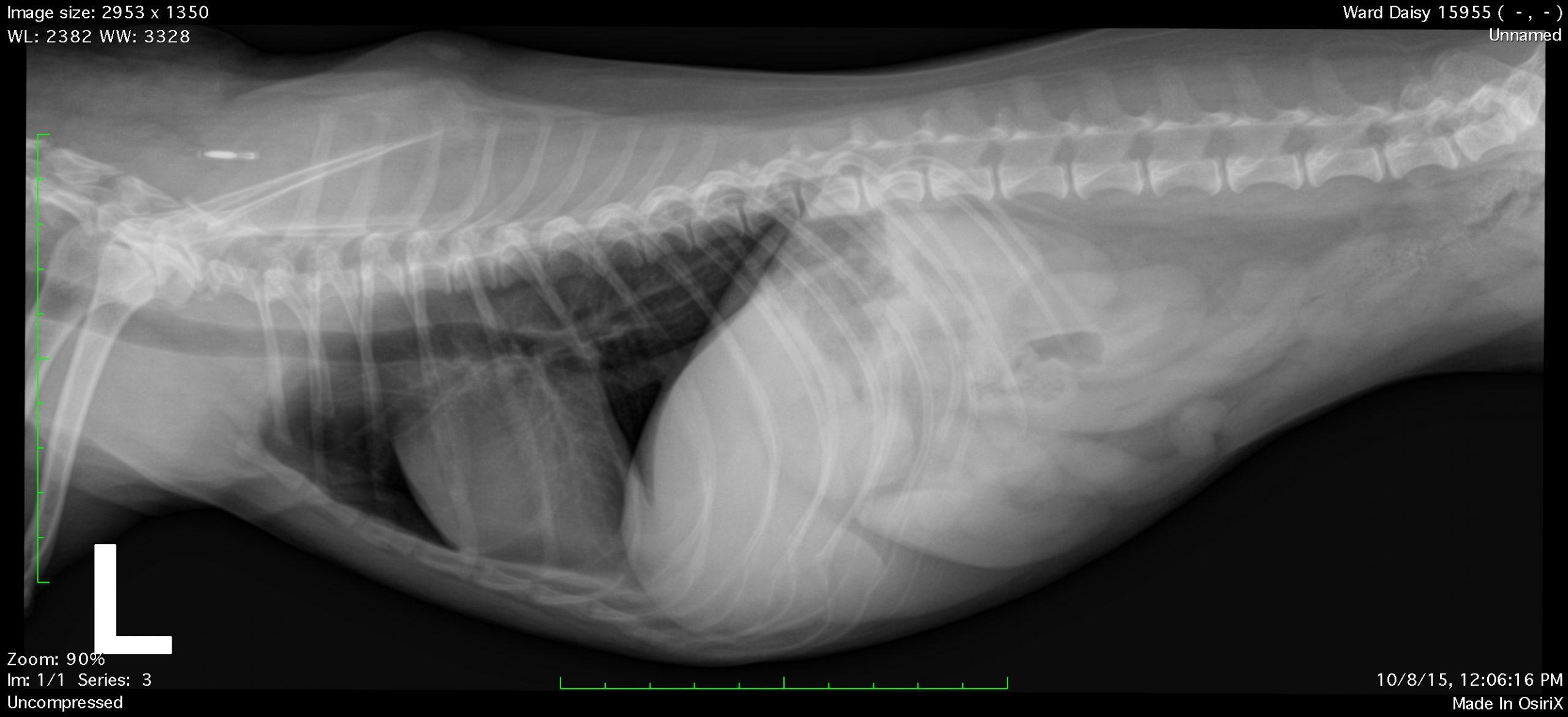 RADS -Hypovolemia, Underperfusion of the Lung, and Secondary Ileus in a ...