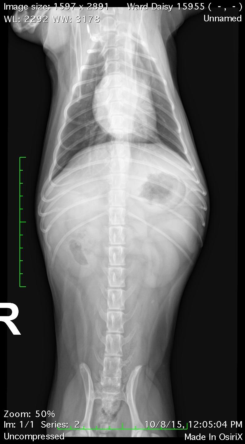RADS -Hypovolemia, Underperfusion of the Lung, and Secondary Ileus in a ...