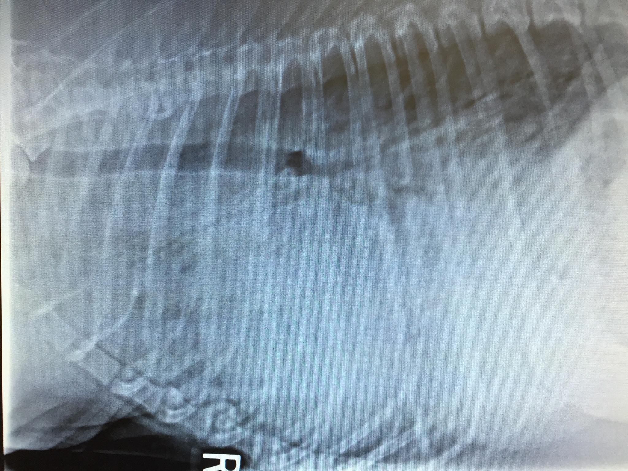 Congestive heart failure due to dilated cardiomyopathy (DCM) in a 6 ...
