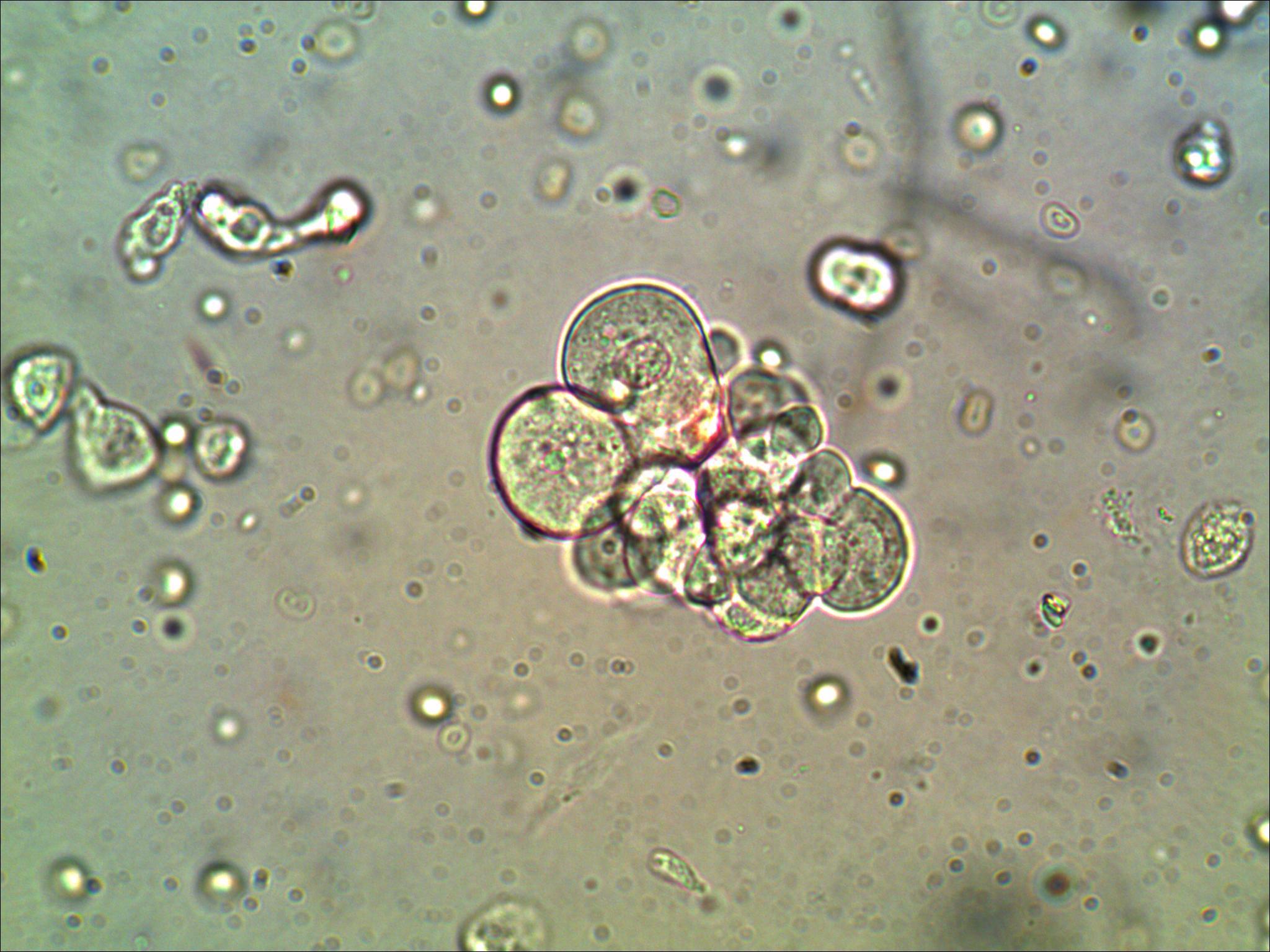 06_00328 Mocha J Bladder and urethral mass - Members