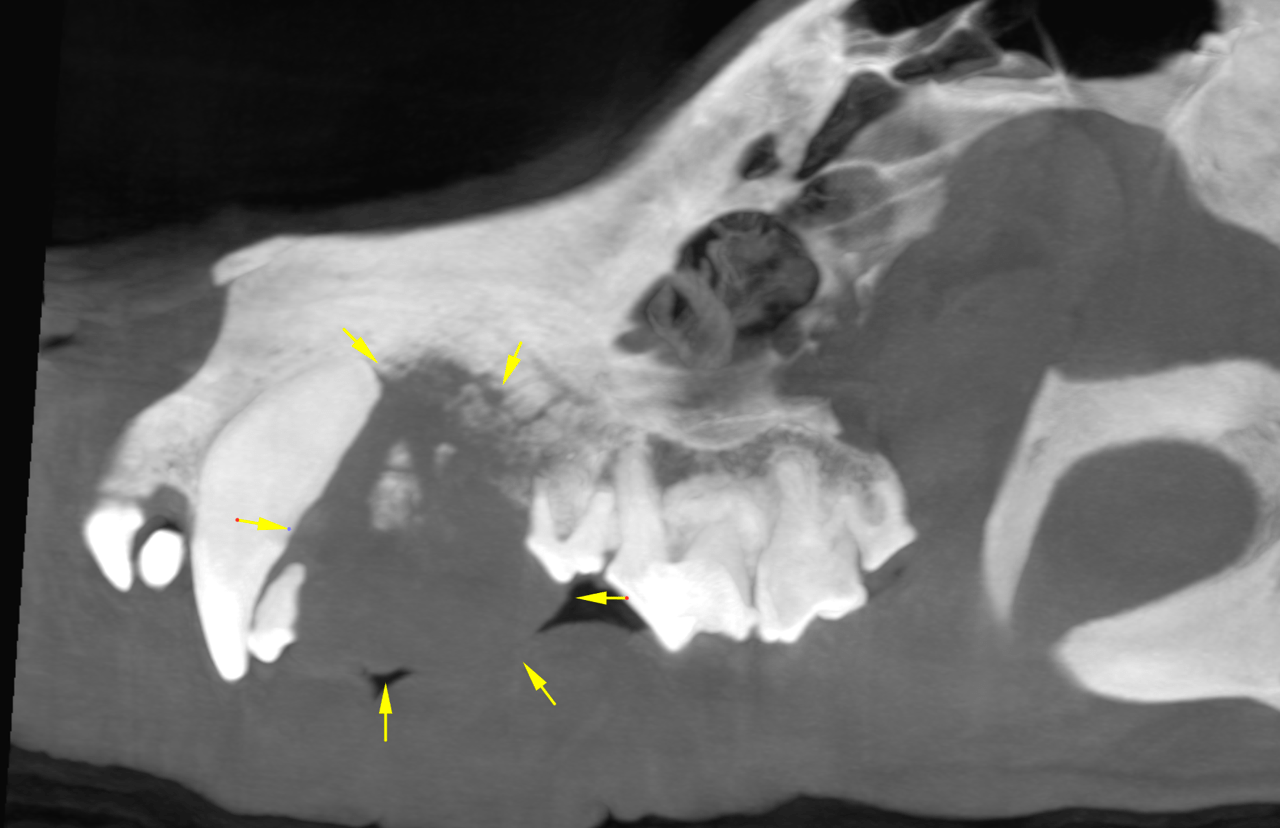 CT - Malignant soft tissue neoplasia with osteolysis of the maxillary ...