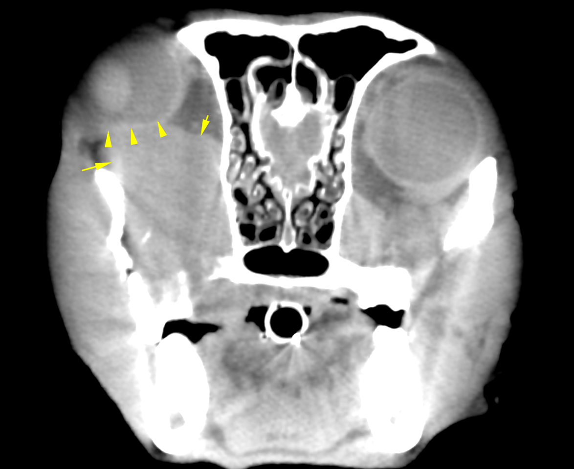 CT - Malignant soft tissue neoplasia with secondary osteolysis of the ...