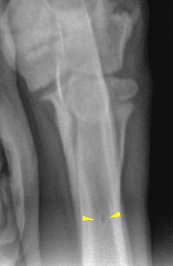 RAD - Eosinophilic Panosteitis in a 12 week old German Shepherd dog ...
