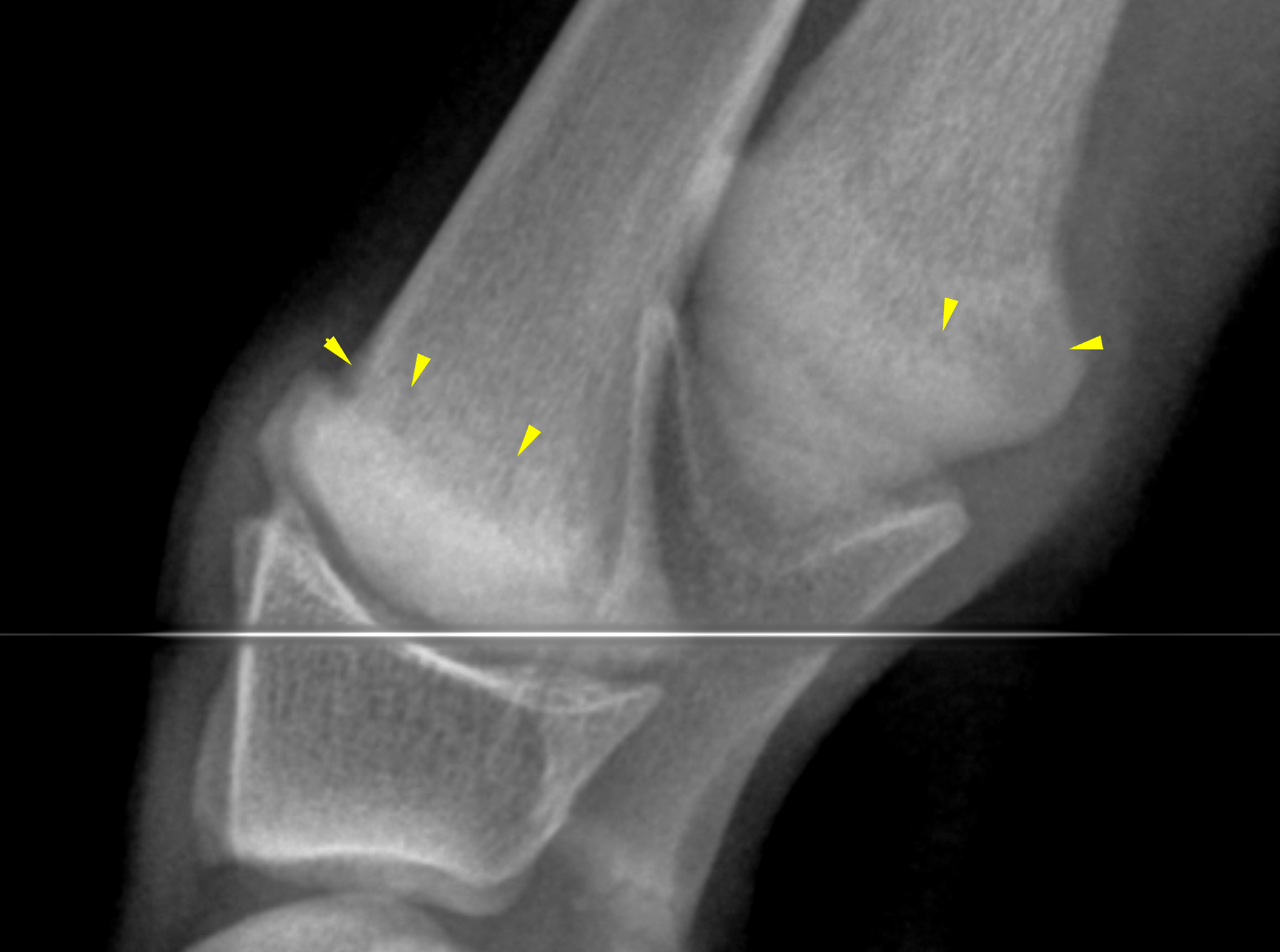 RAD - Eosinophilic Panosteitis in a 12 week old German Shepherd dog ...